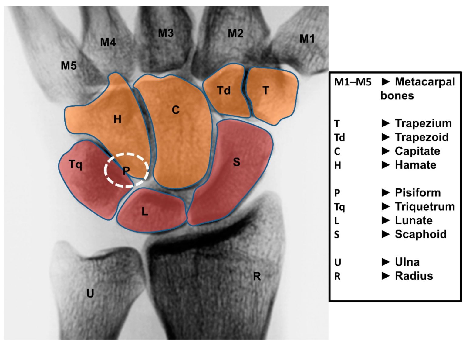 Anatomie zápěstí: Klíčové struktury pro funkci ruky - Ortopedická ...